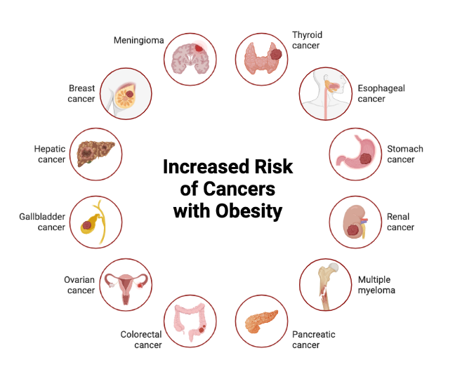 Increased Risk of Cancers with Obesity | BioRender Science Templates