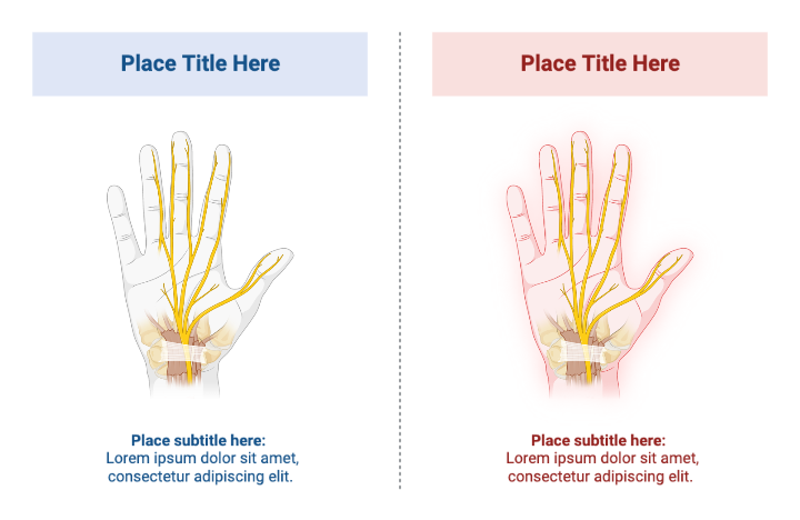 Hand Comparison (Layout) | BioRender Science Templates