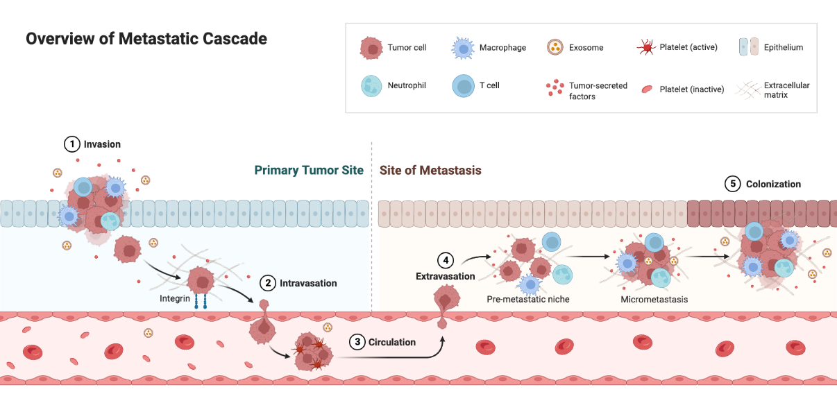 Overview of Metastatic Cascade | BioRender Science Templates