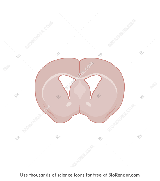 Free Mouse brain (coronal, lateral ventricles, Huntington's disease ...
