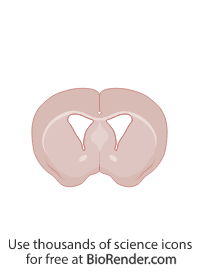 Free Mouse brain (coronal, lateral ventricles, Huntington's disease ...
