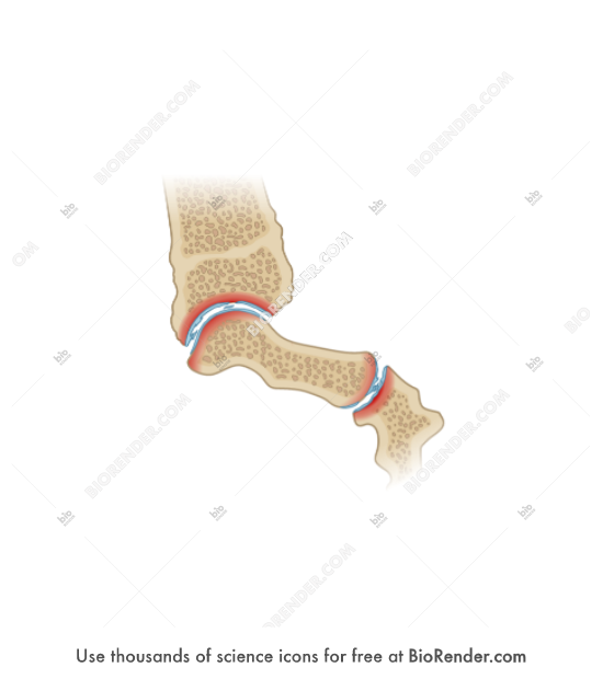 Free Mouse tibia-talus-tarsal joint (arthritic) Icons, Symbols & Images ...