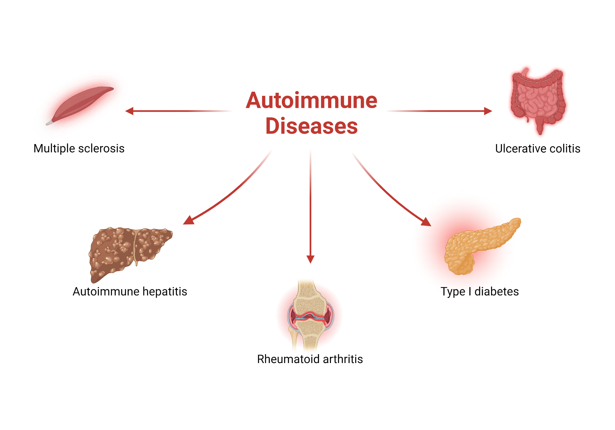 Autoimmune Diseases | BioRender Science Templates