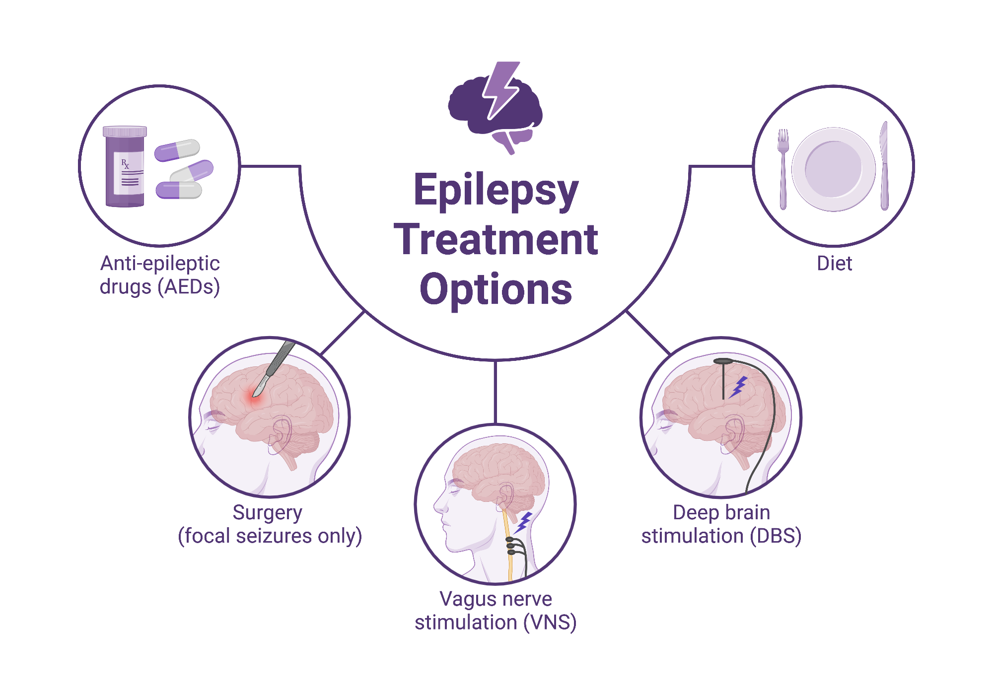 Epilepsy Treatment Options | BioRender Science Templates