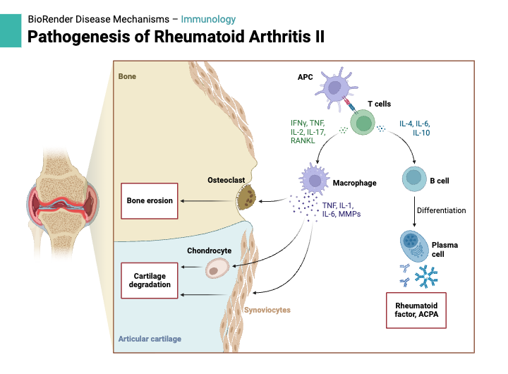 Pathogenesis of Rheumatoid Arthritis II (with Callout) | BioRender ...