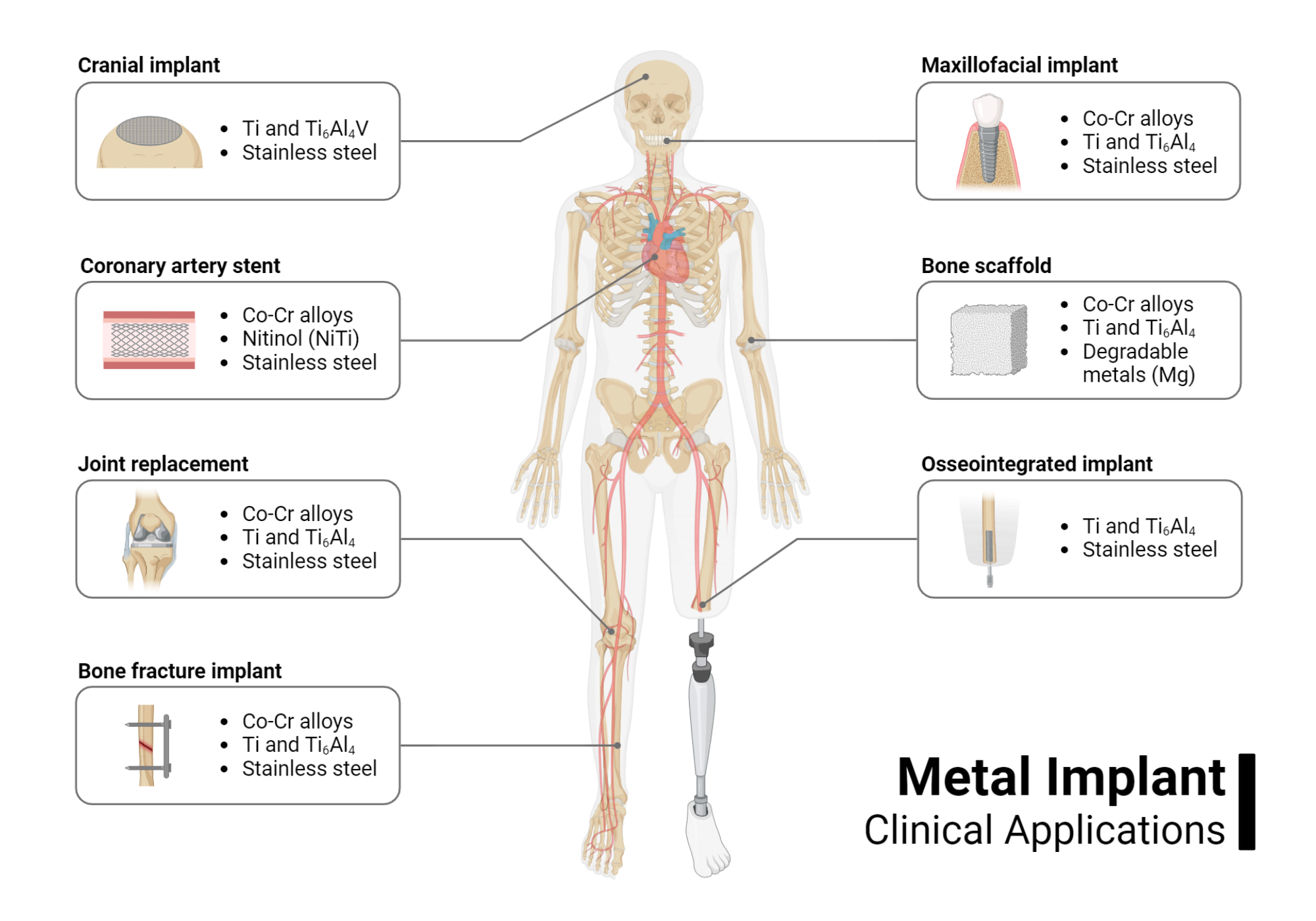 Metal Implant Clinical Applications | BioRender Science Templates