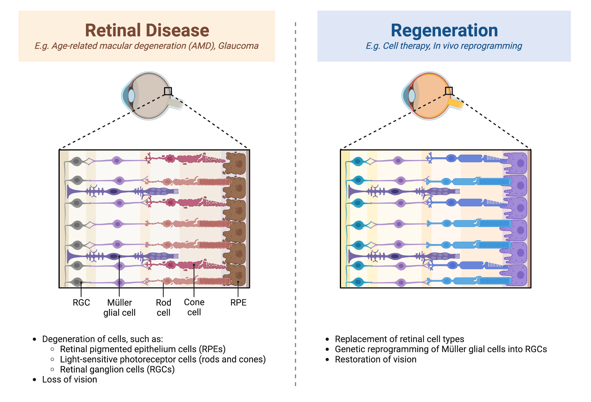 Retinal Disease and Regeneration | BioRender Science Templates