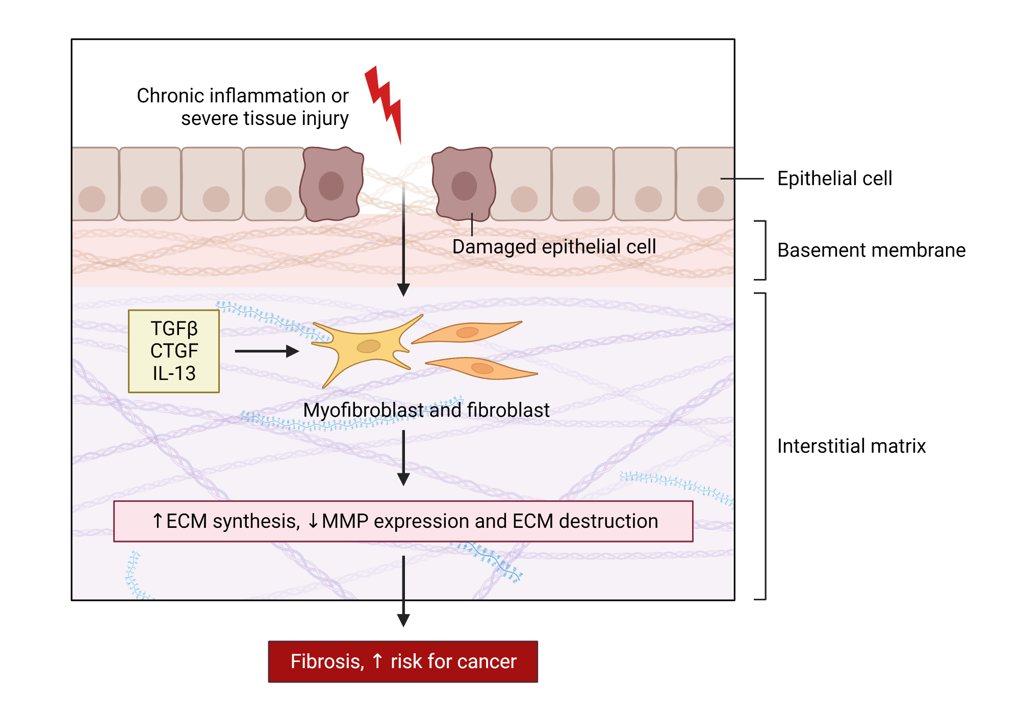 Over-production of Extracellular Matrix and Cancer Risk | BioRender ...