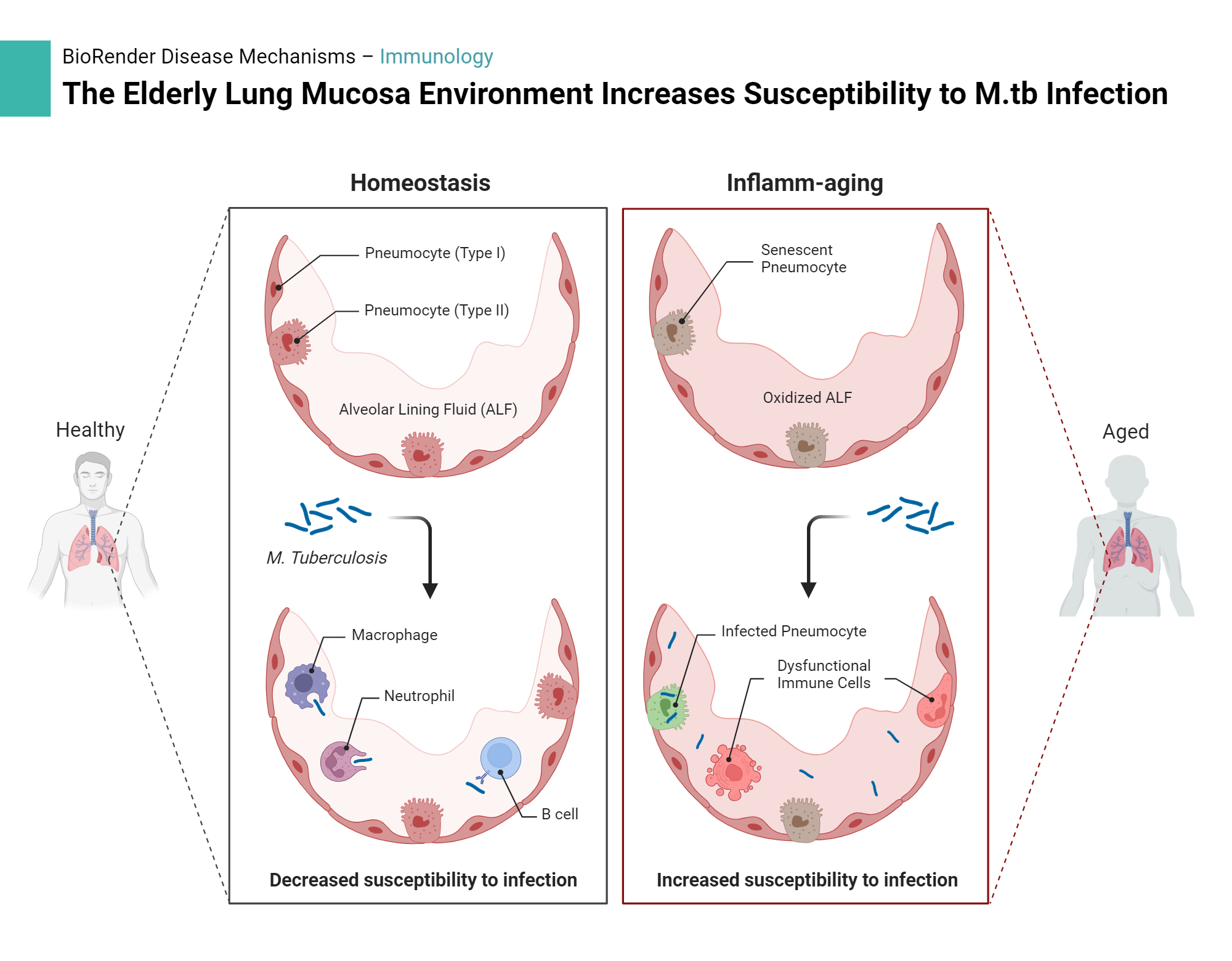 The Elderly Lung Mucosa Environment Increases Susceptibility to M.tb ...