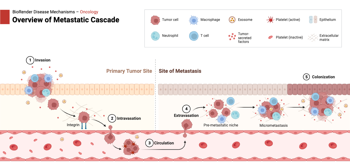 Overview of Metastatic Cascade | BioRender Science Templates