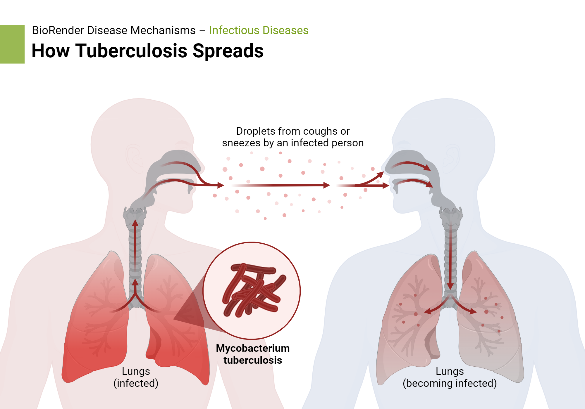 How Tuberculosis Spreads | BioRender Science Templates