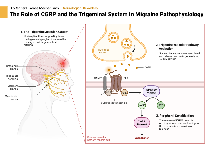 The Role of CGRP and the Trigeminal System in Migraine Pathophysiology ...