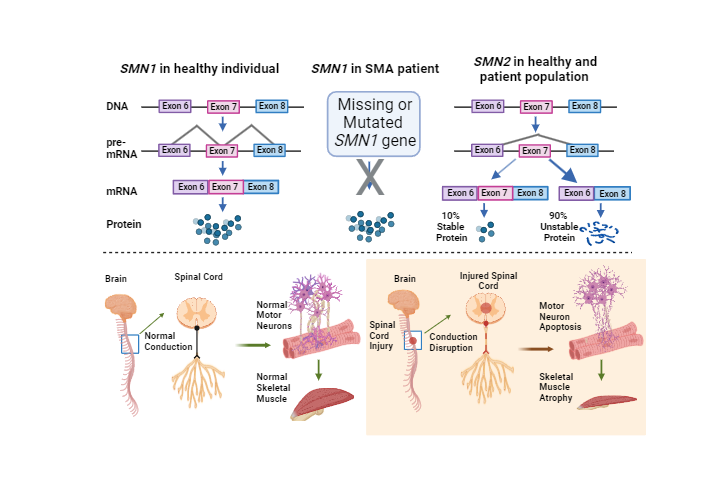 SMN in SMA patient - Jannatun Nayem's drawing | BioRender Science Templates