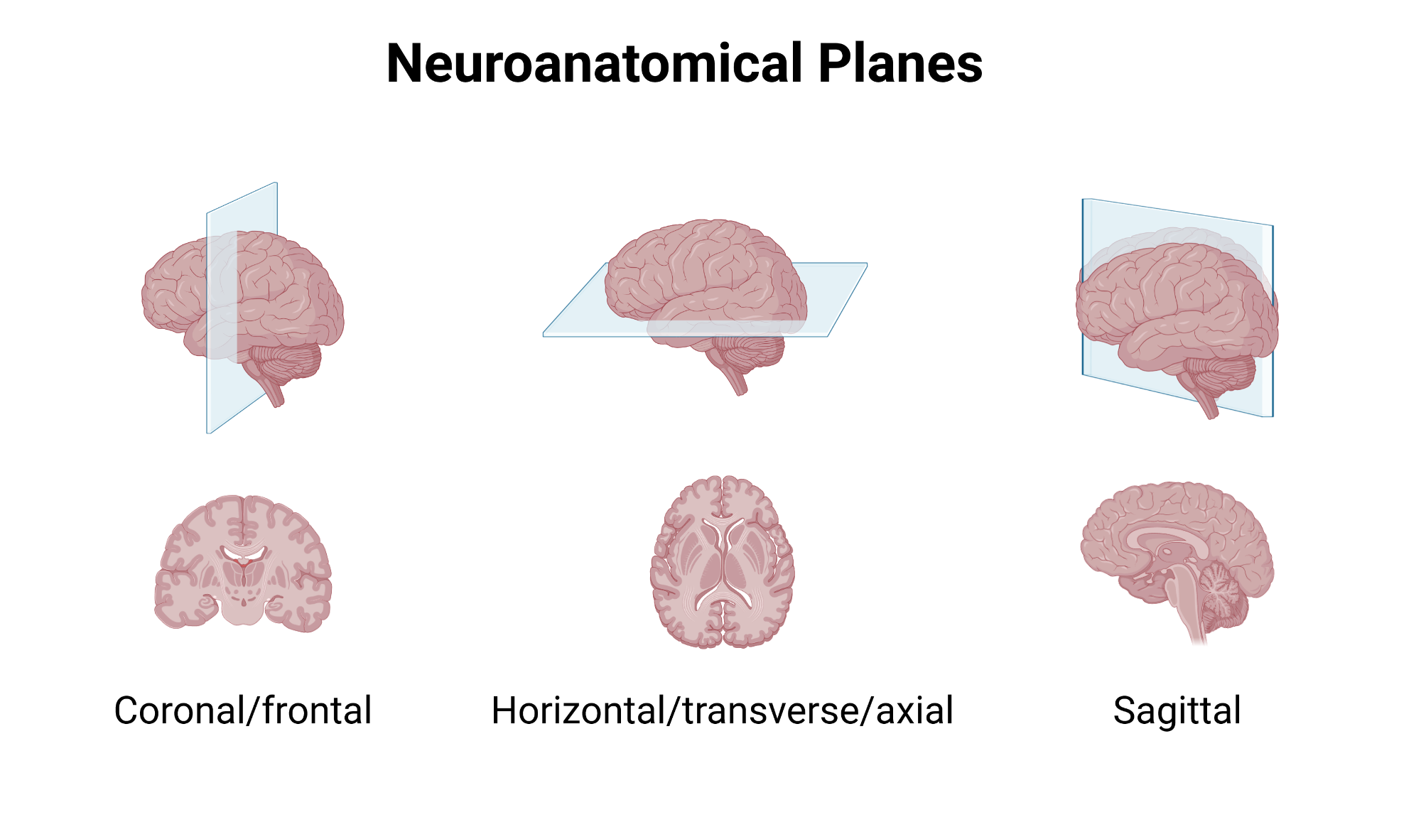 Neuroanatomical Planes in Human Brains | BioRender Science Templates