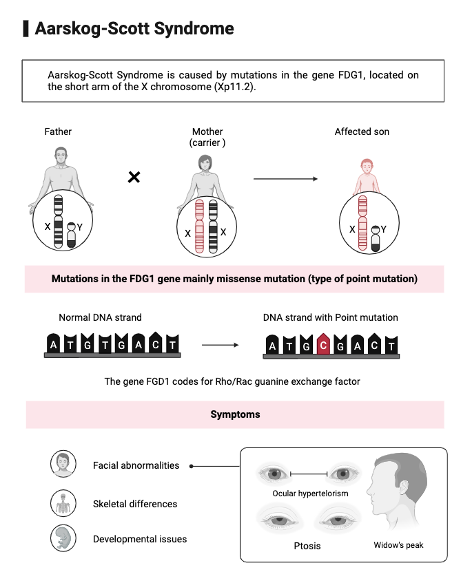 Aarskog-Scott Syndrome | BioRender Science Templates