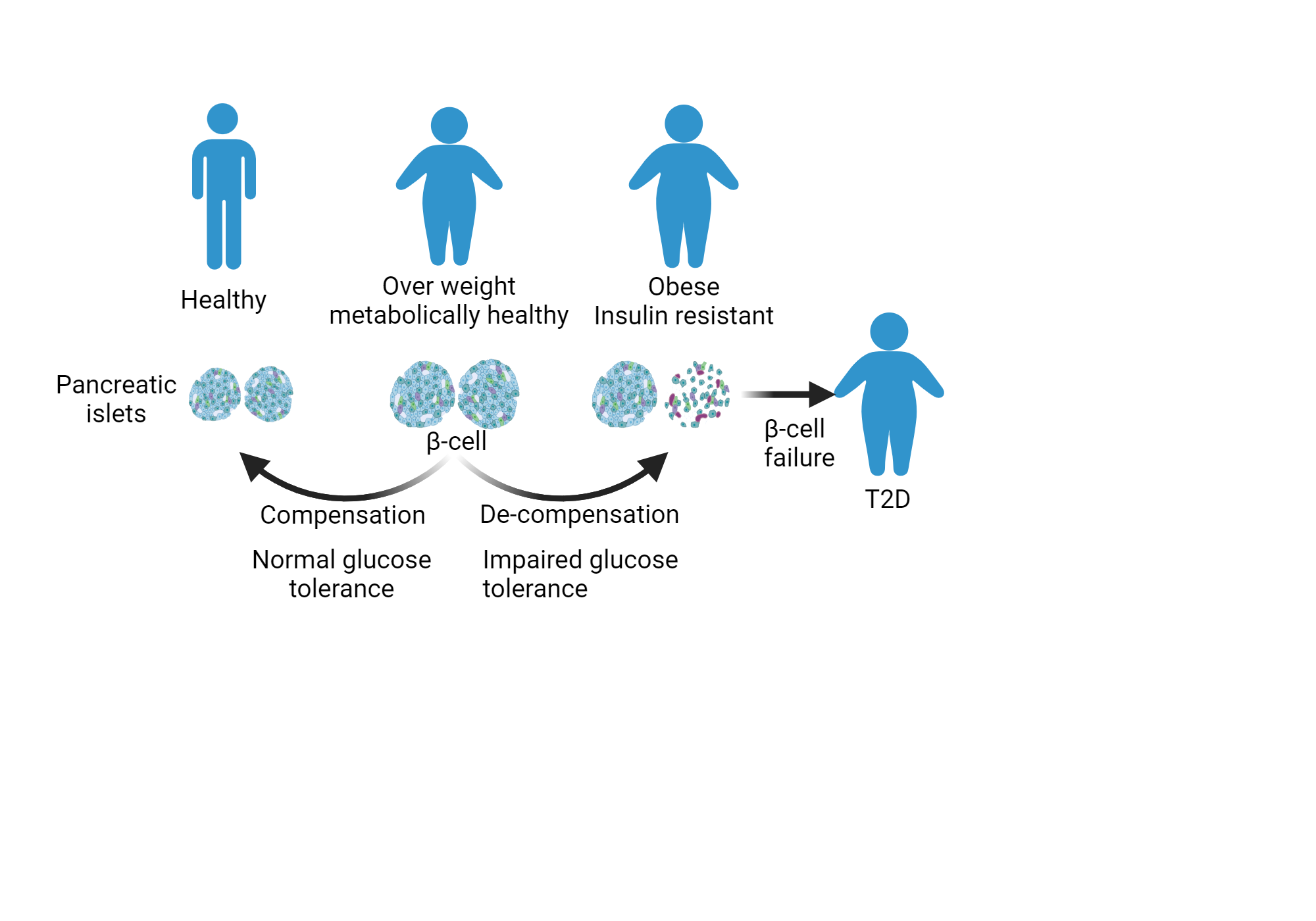 Pancreatic beta cell decompensation and progression to T2D | BioRender ...