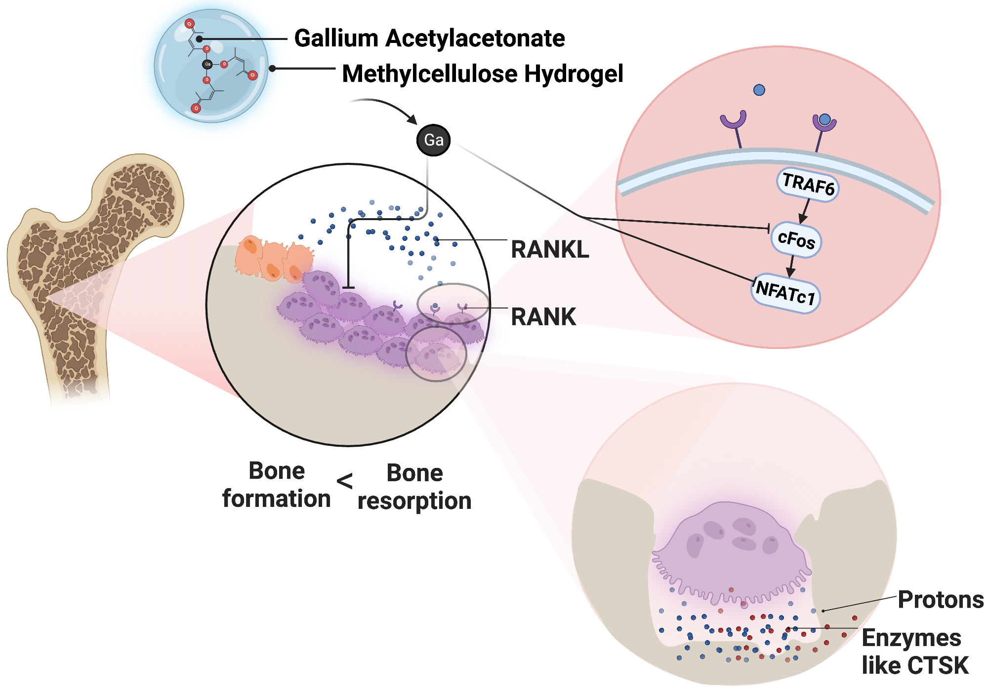 Thermoresponsive hydrogels loaded with gallium acetylacetonate in ...