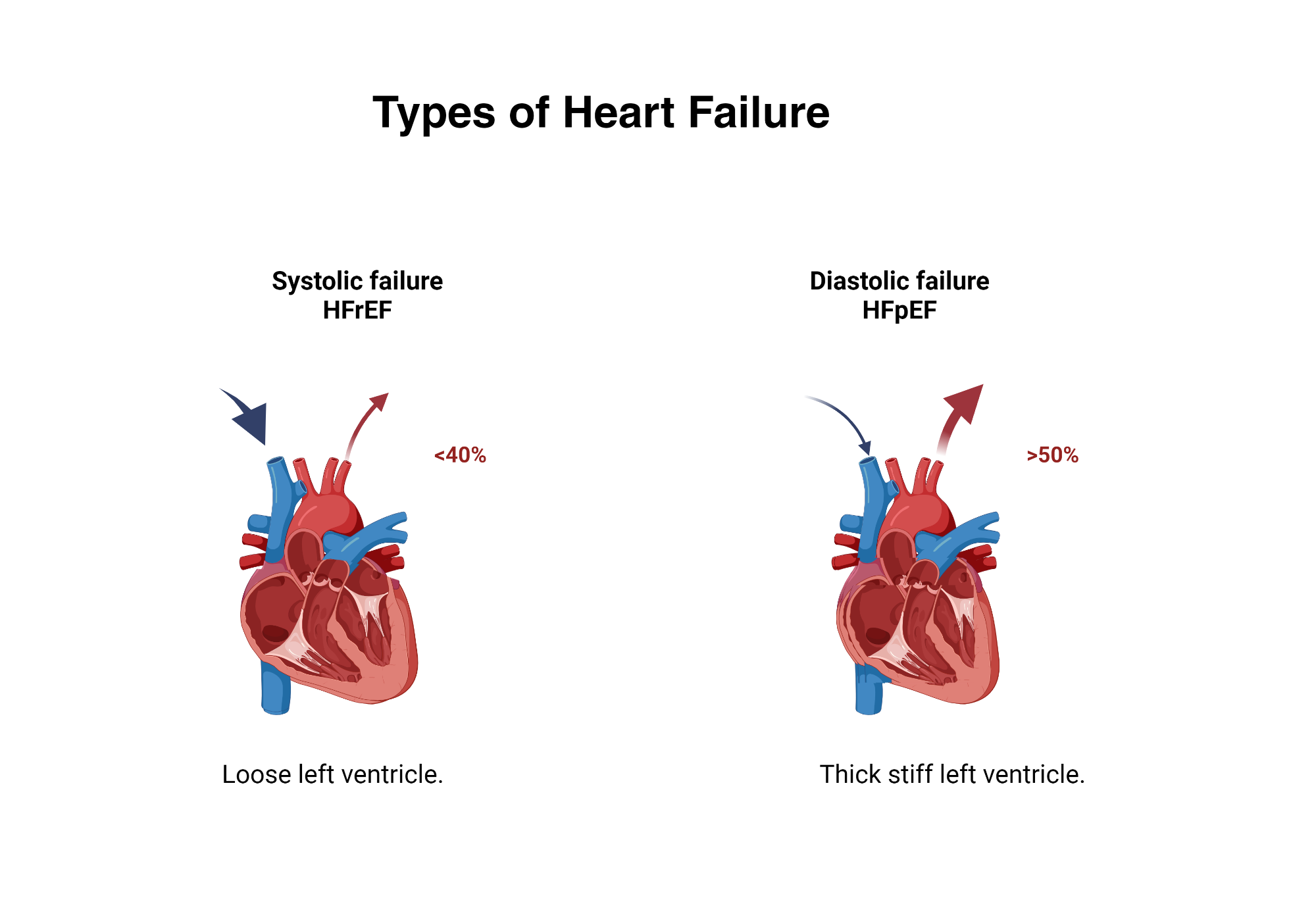 Heart Failure | BioRender Science Templates