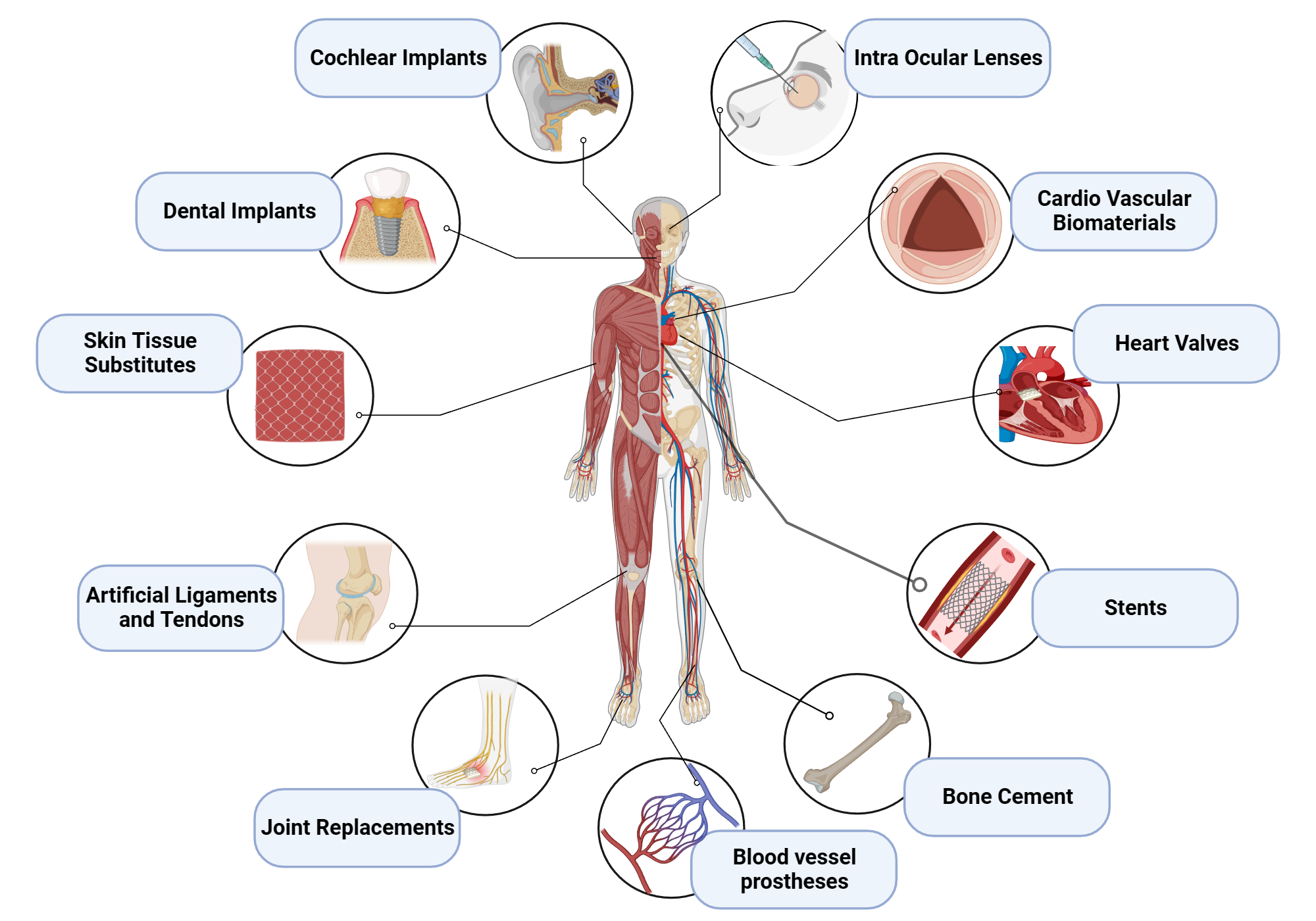 Biomedical applications of Implants | BioRender Science Templates