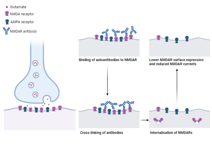 NMDAR encephalitis | BioRender Science Templates
