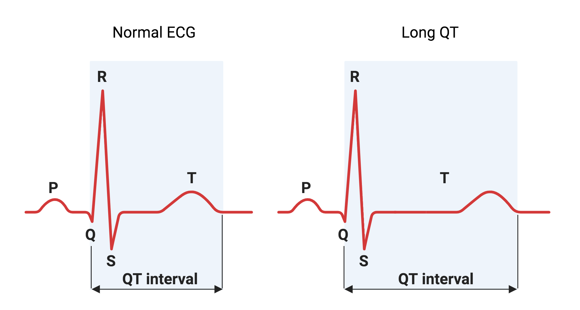 Long QT | BioRender Science Templates