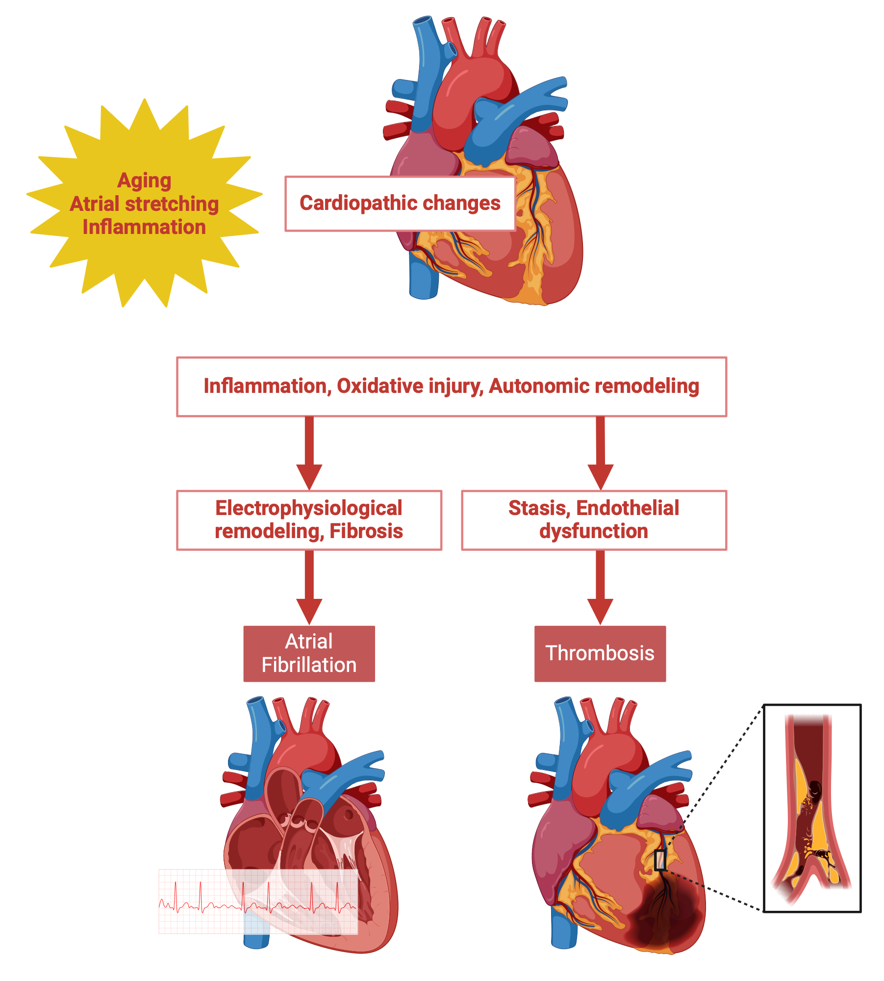 Pathophysiological Sequelae of Atrial Myopathy | BioRender Science ...