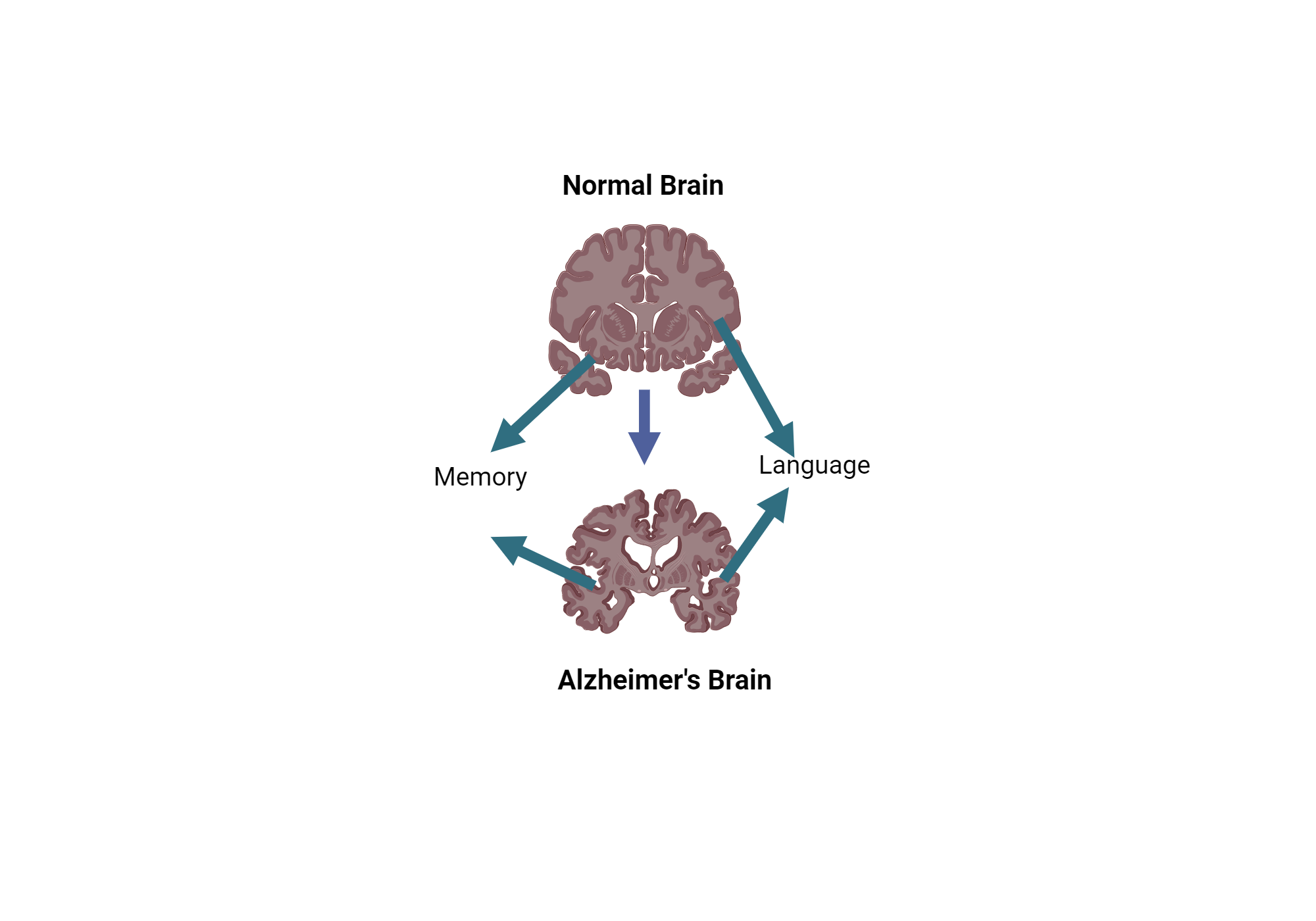 NORMAL BRAIN VS Alzheimer BRAIN | BioRender Science Templates
