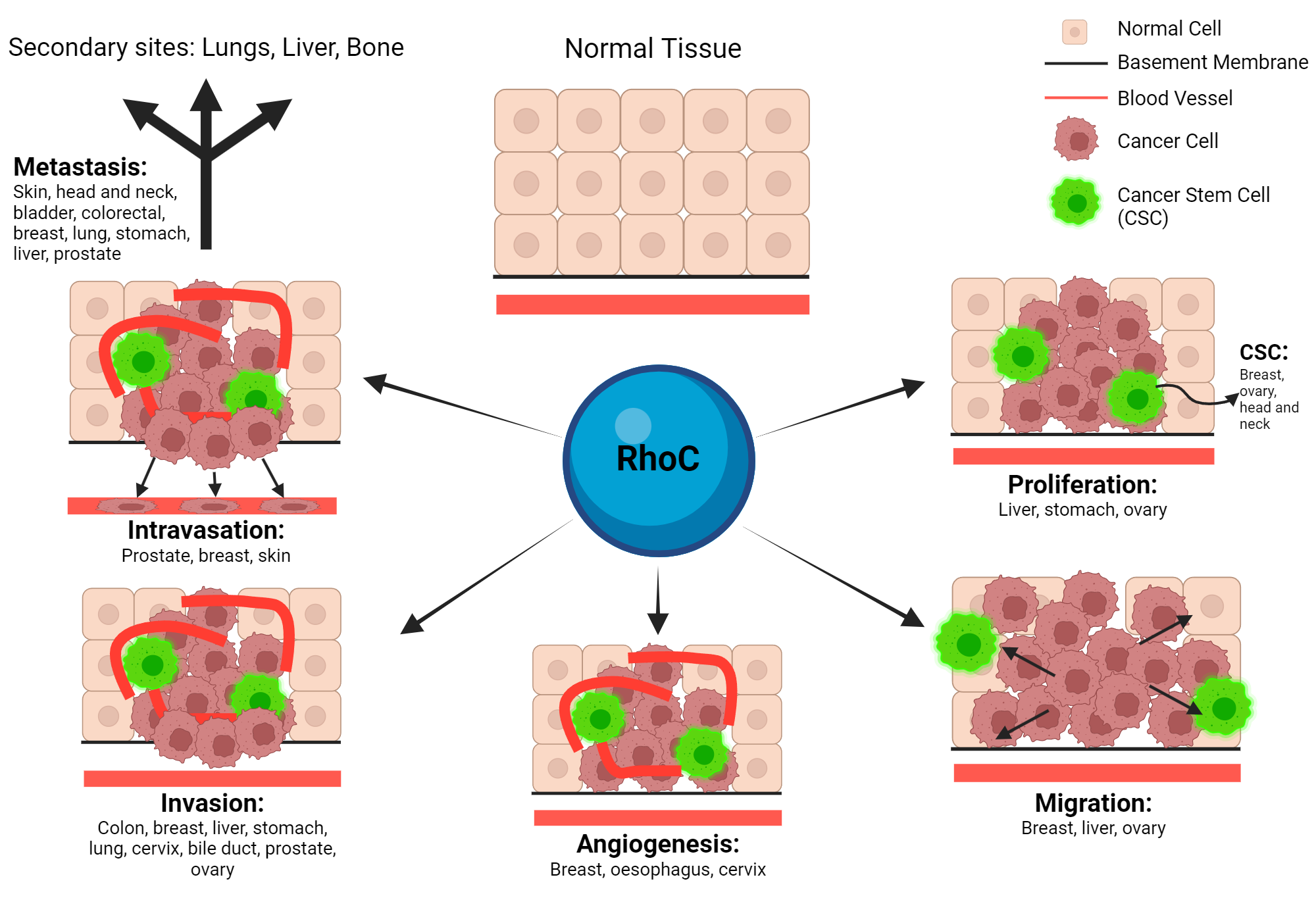 RhoC’s multifaceted role in cancer progression and metastasis induction ...