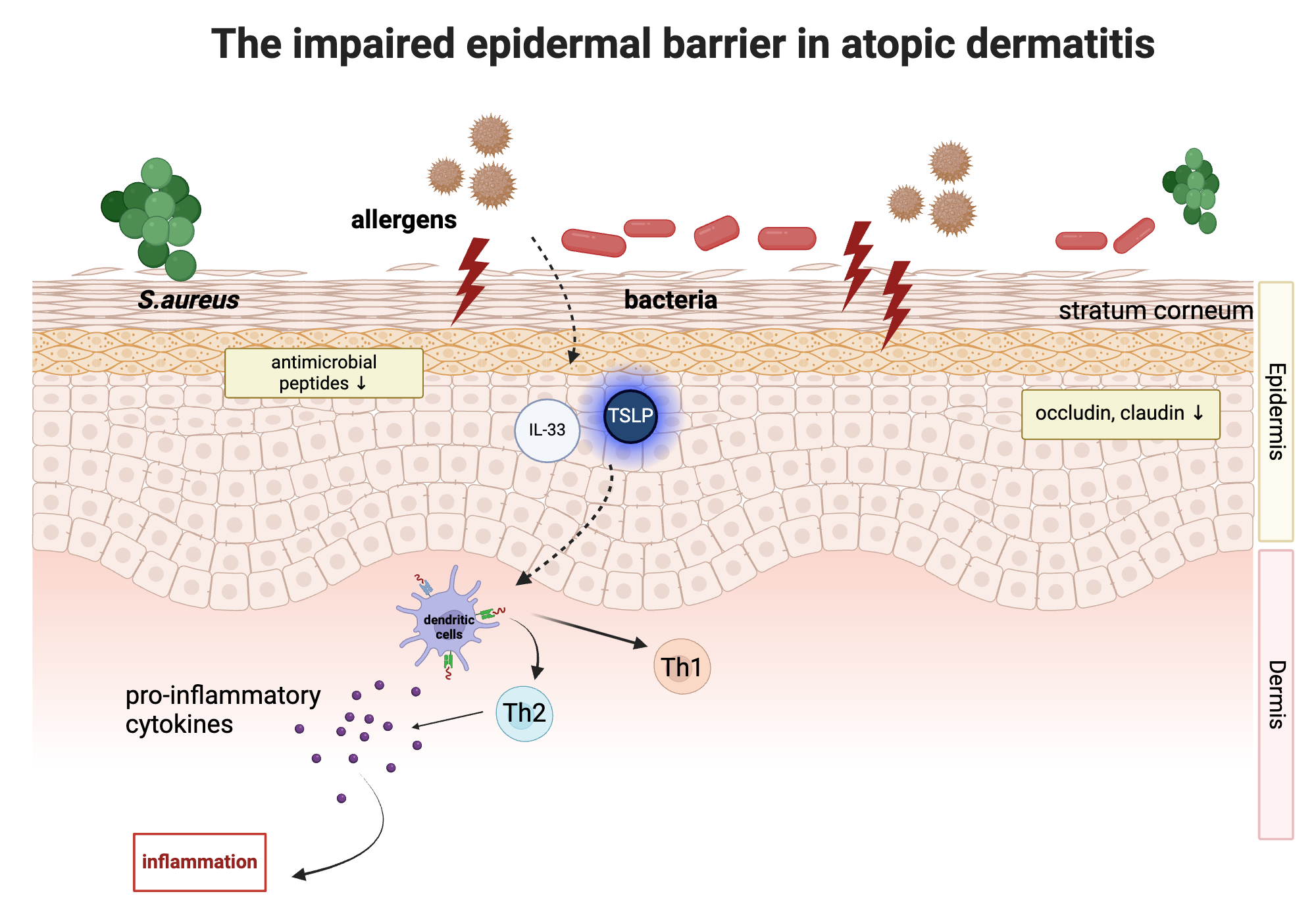 impaired epidermal barrier in atopic dermatitis | BioRender Science ...