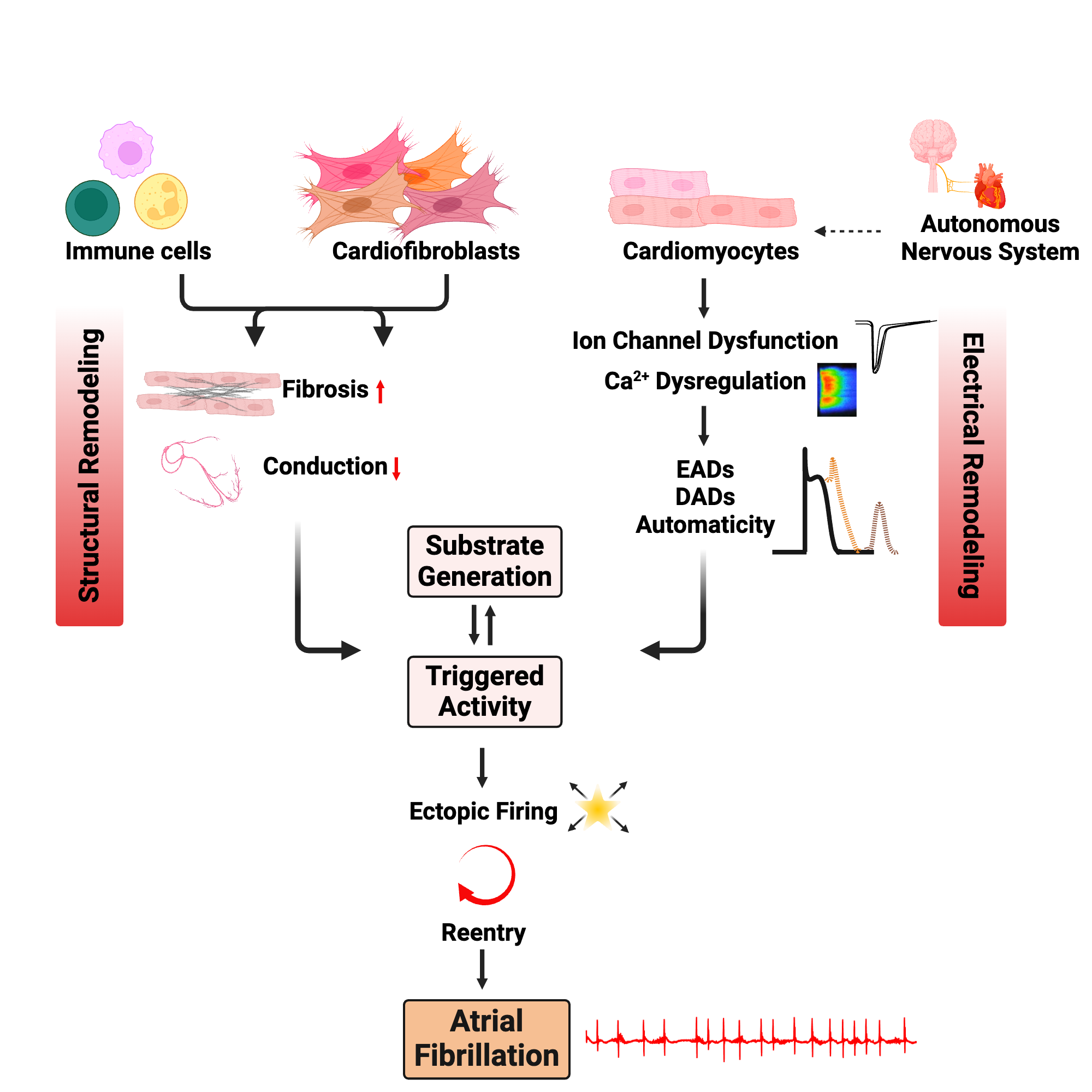 Mechanisms of Atrial Fibrillation | BioRender Science Templates