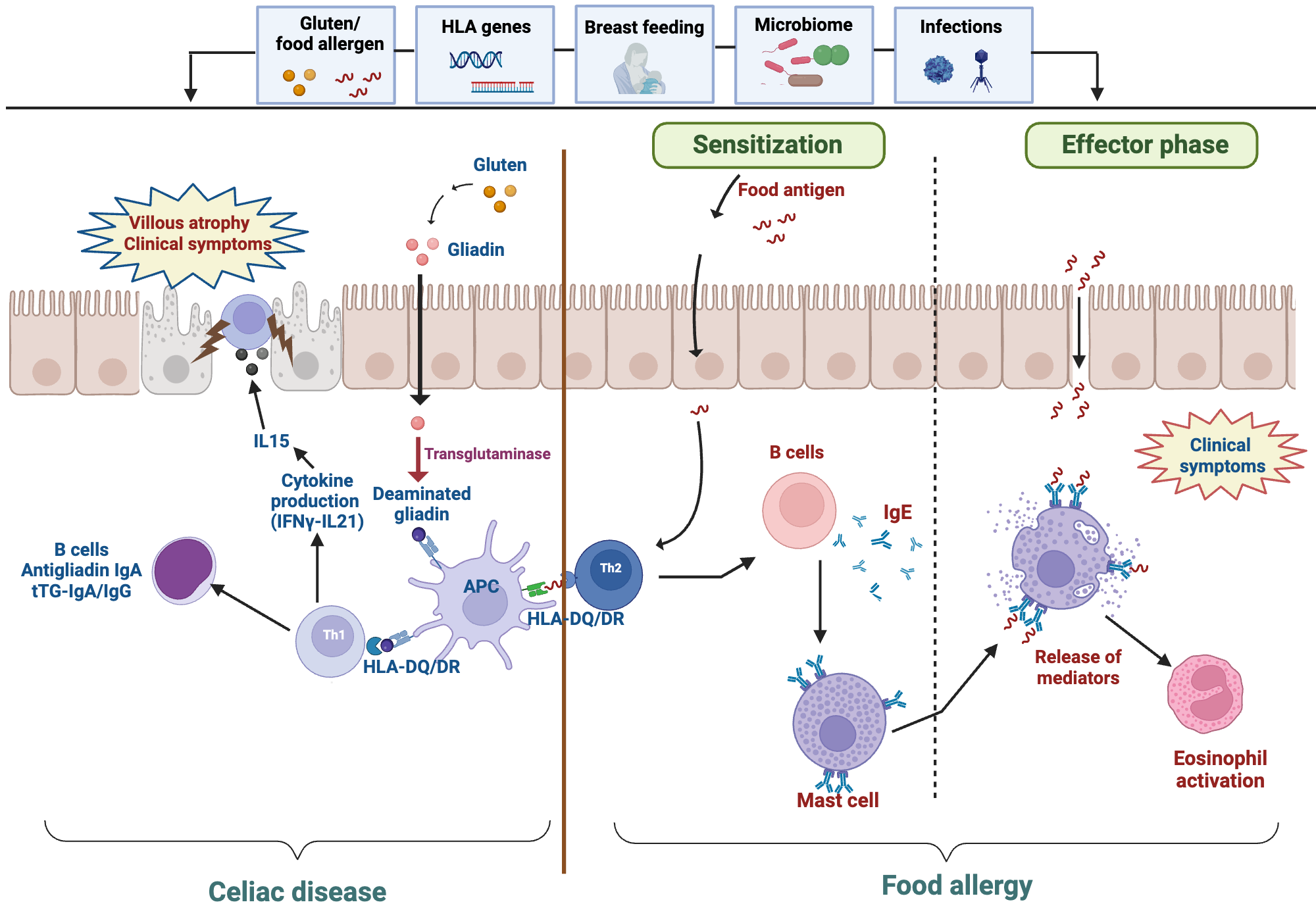 IgE-dependent food allergy & celiac disease: Immunological mechanisms ...