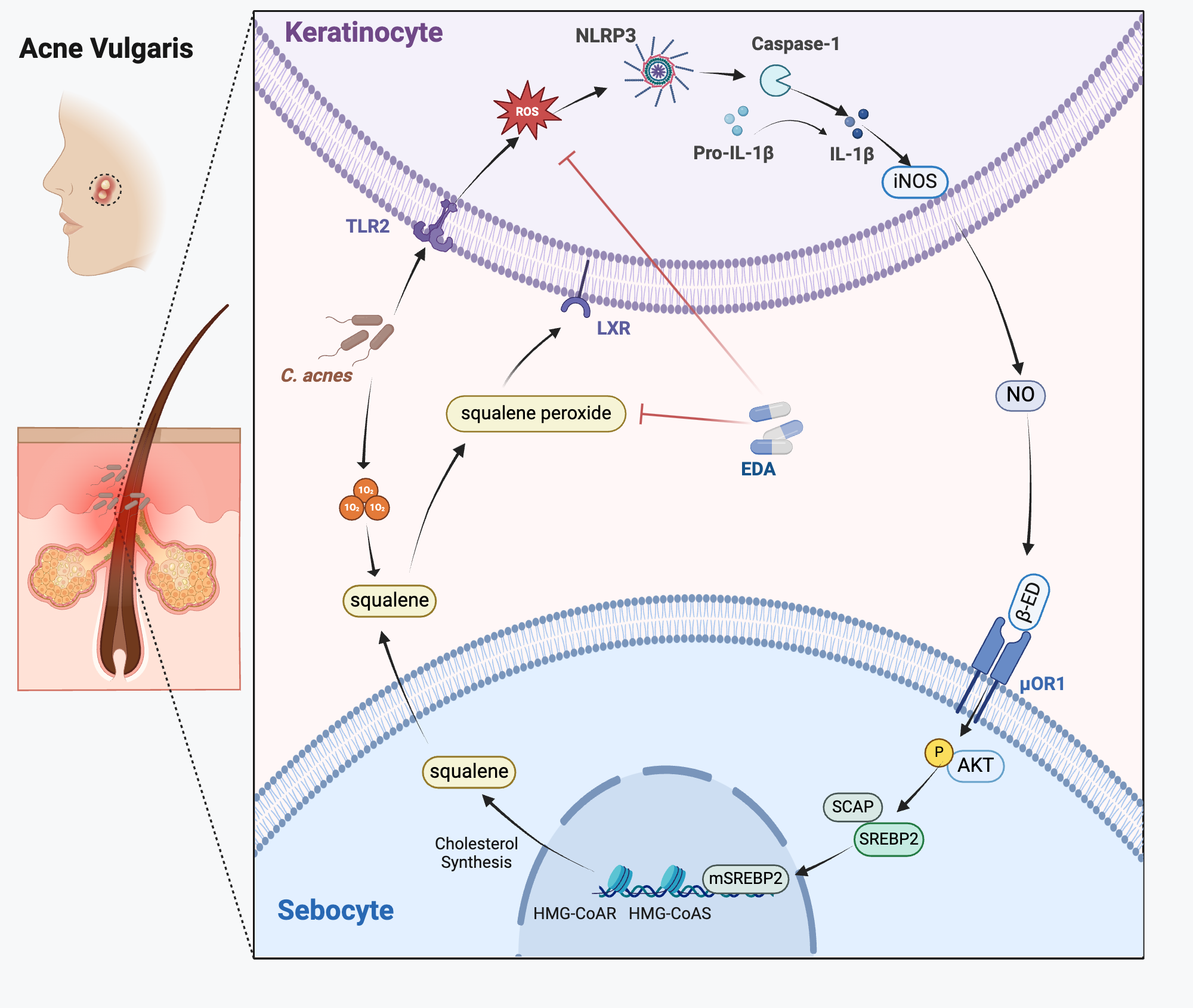 acne | BioRender Science Templates