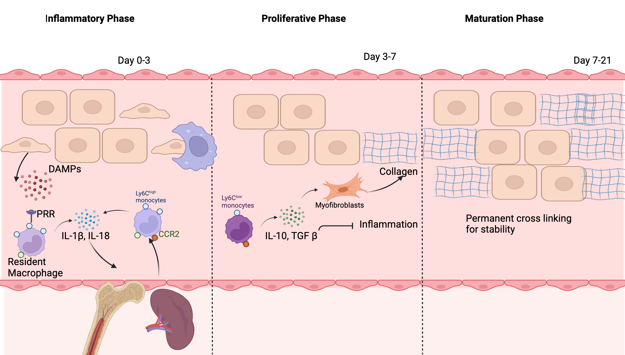 Immune response in cardiac fibrosis | BioRender Science Templates