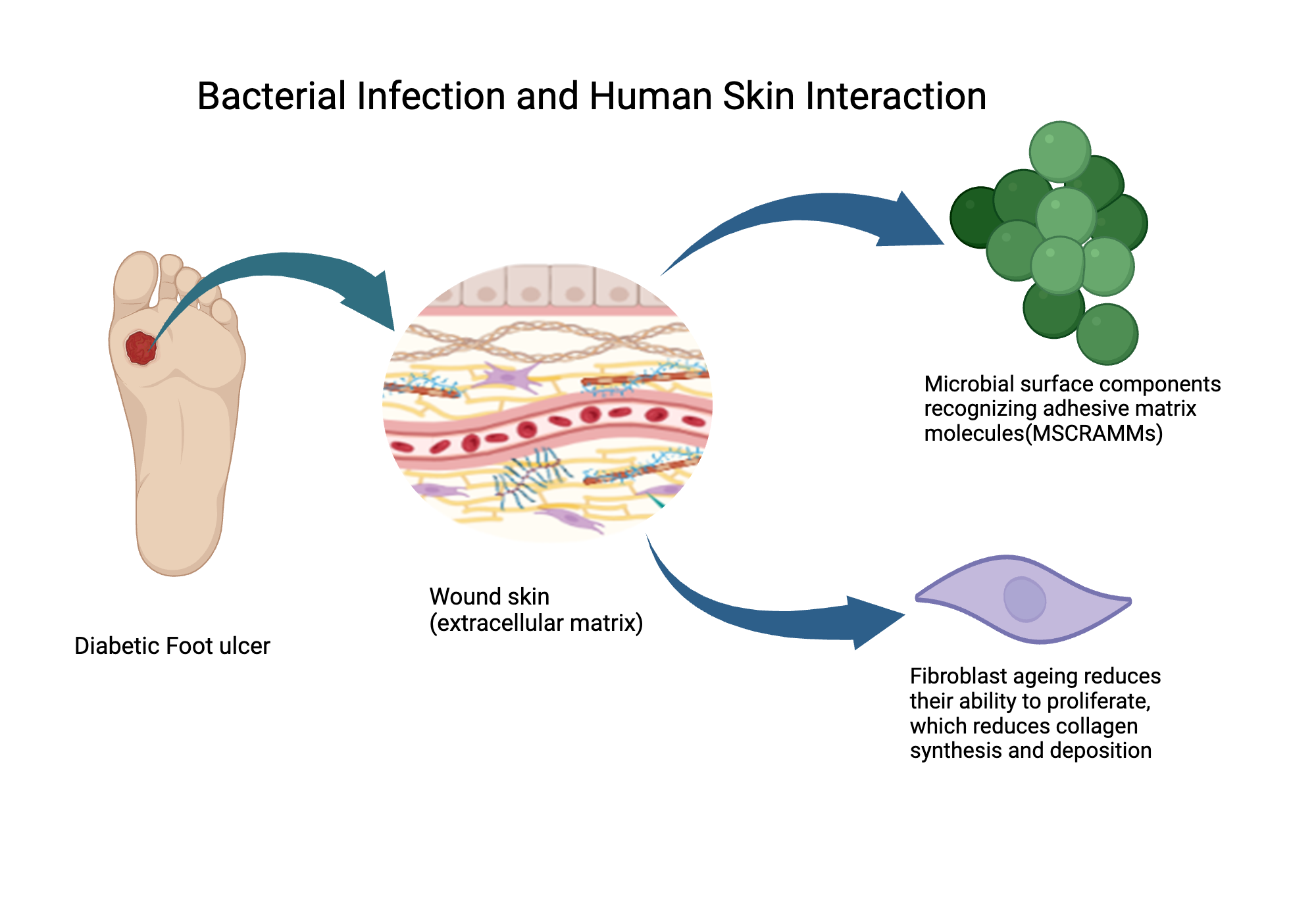 Bacterial infection and human interaction | BioRender Science Templates