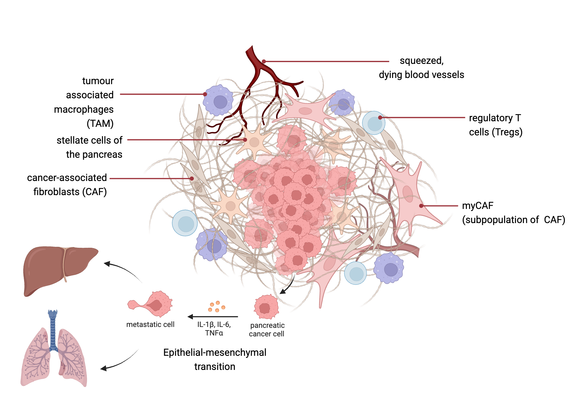 pancreatic cancer niche and metastasis | BioRender Science Templates