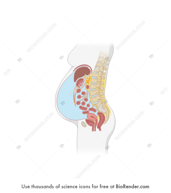 Free Adult female (sagittal, with ascites) Icons, Symbols & Images ...