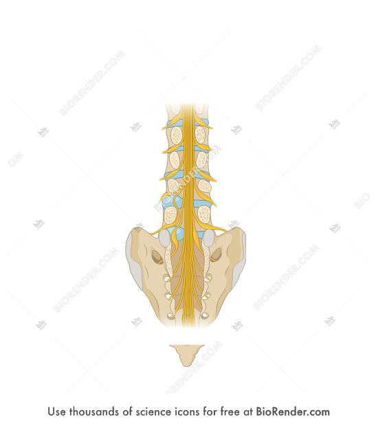 Free Spinal disc herniation (lumbar and sacral) Icons, Symbols & Images ...