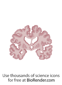 Free Brain with Alzheimer's (coronal cut, at basal ganglia) Icons ...