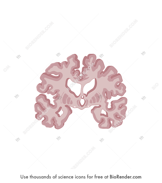 Free Brain with Alzheimer's (coronal cut, at basal ganglia) Icons ...