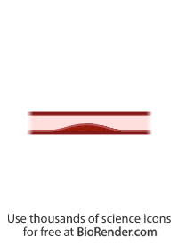 Free Blood vessel (cut, artery dissection, type 2) Icons, Symbols ...