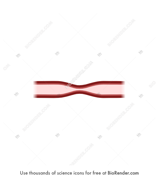 Free Blood vessel (cut, vasospasm) Icons, Symbols & Images | BioRender