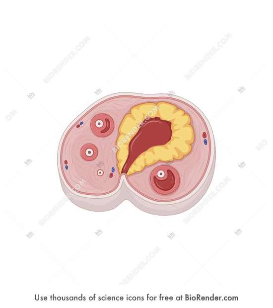 Free Horse ovary (cross-section, new corpus luteum) Icons, Symbols ...
