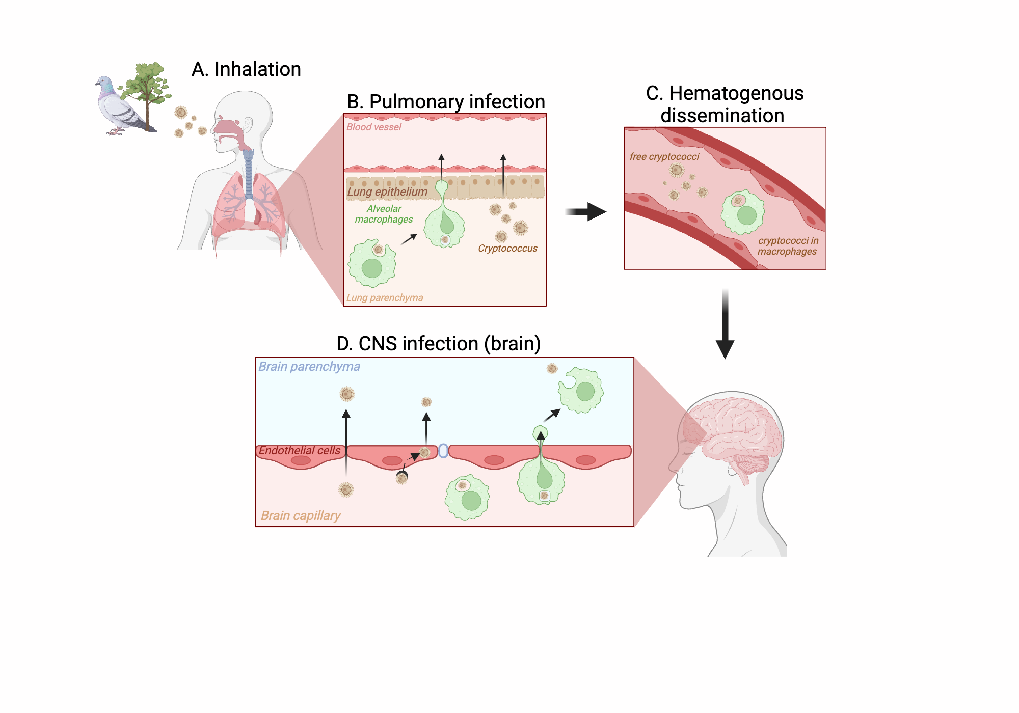 Cryptococcal infection | BioRender Science Templates