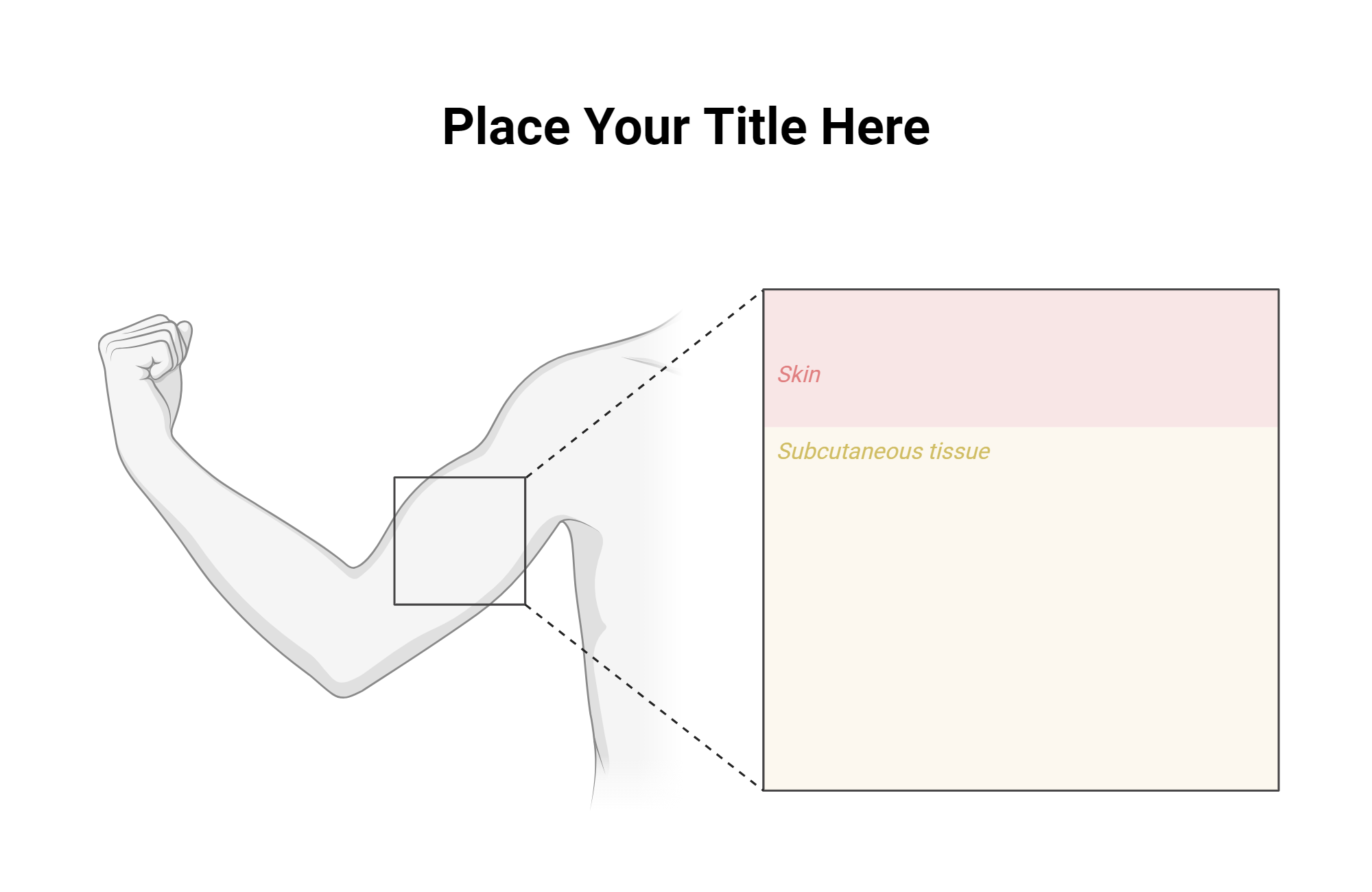 Arm with Skin Callout (Layout) | BioRender Science Templates