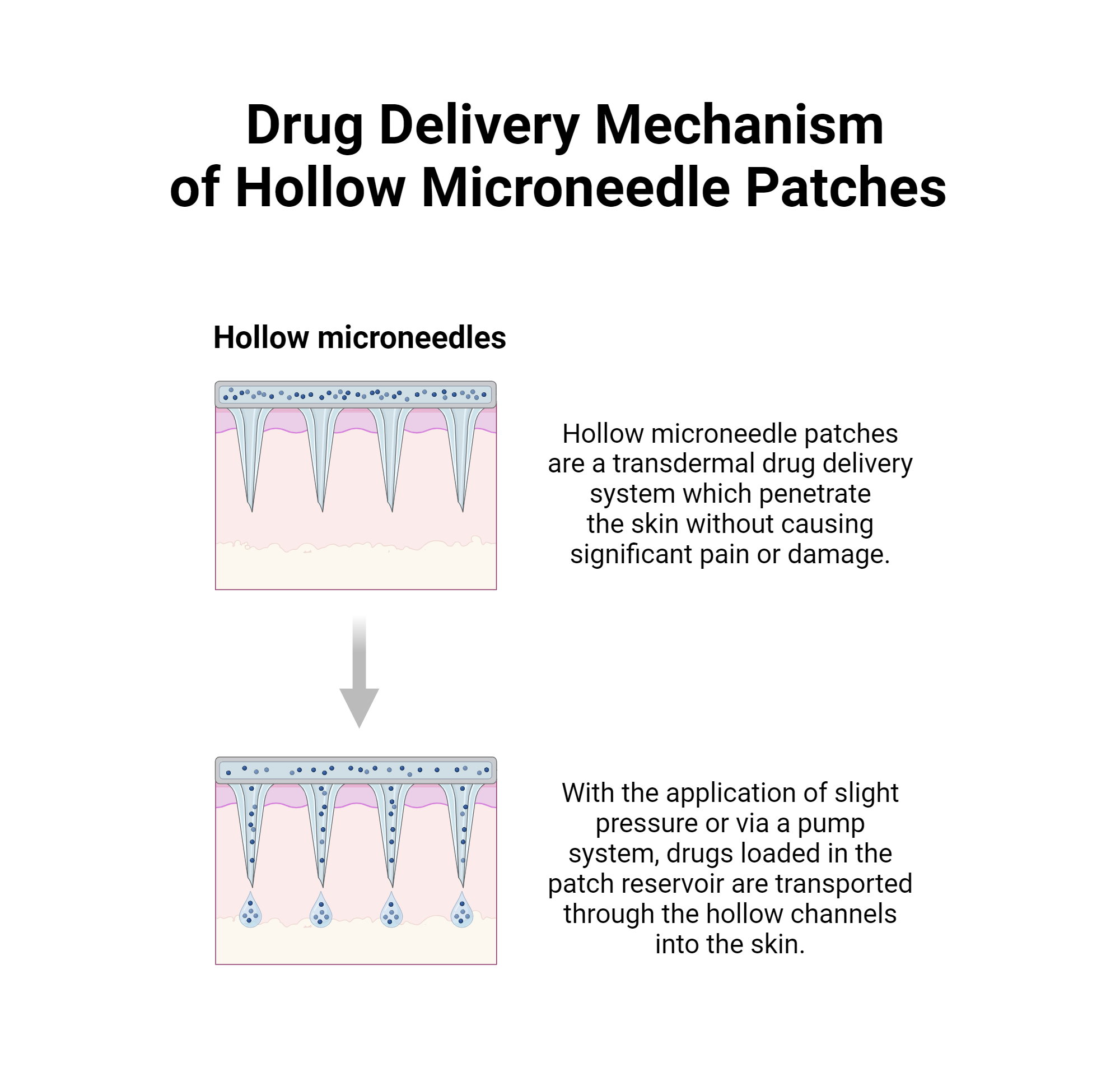 Drug Delivery Mechanism of Hollow Microneedle Patches | BioRender ...