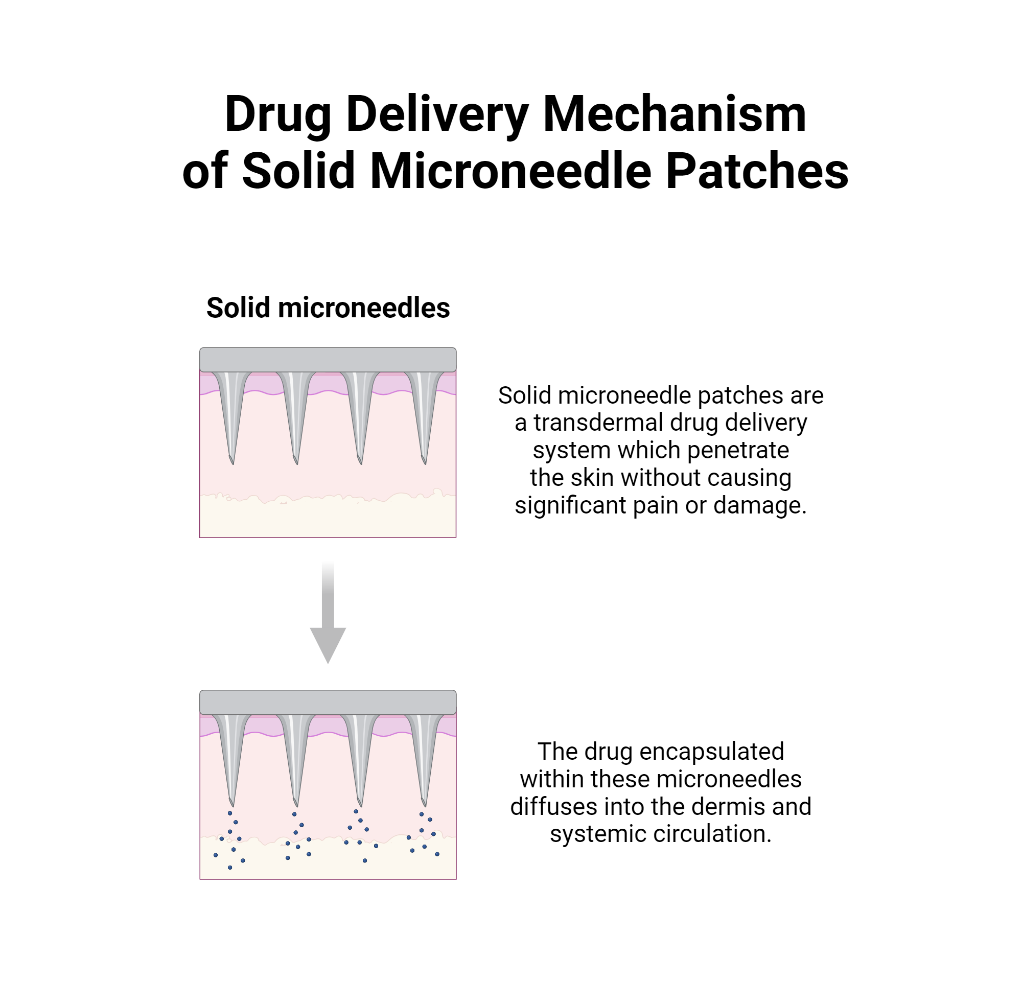 Drug Delivery Mechanism of Solid Microneedle Patches | BioRender ...