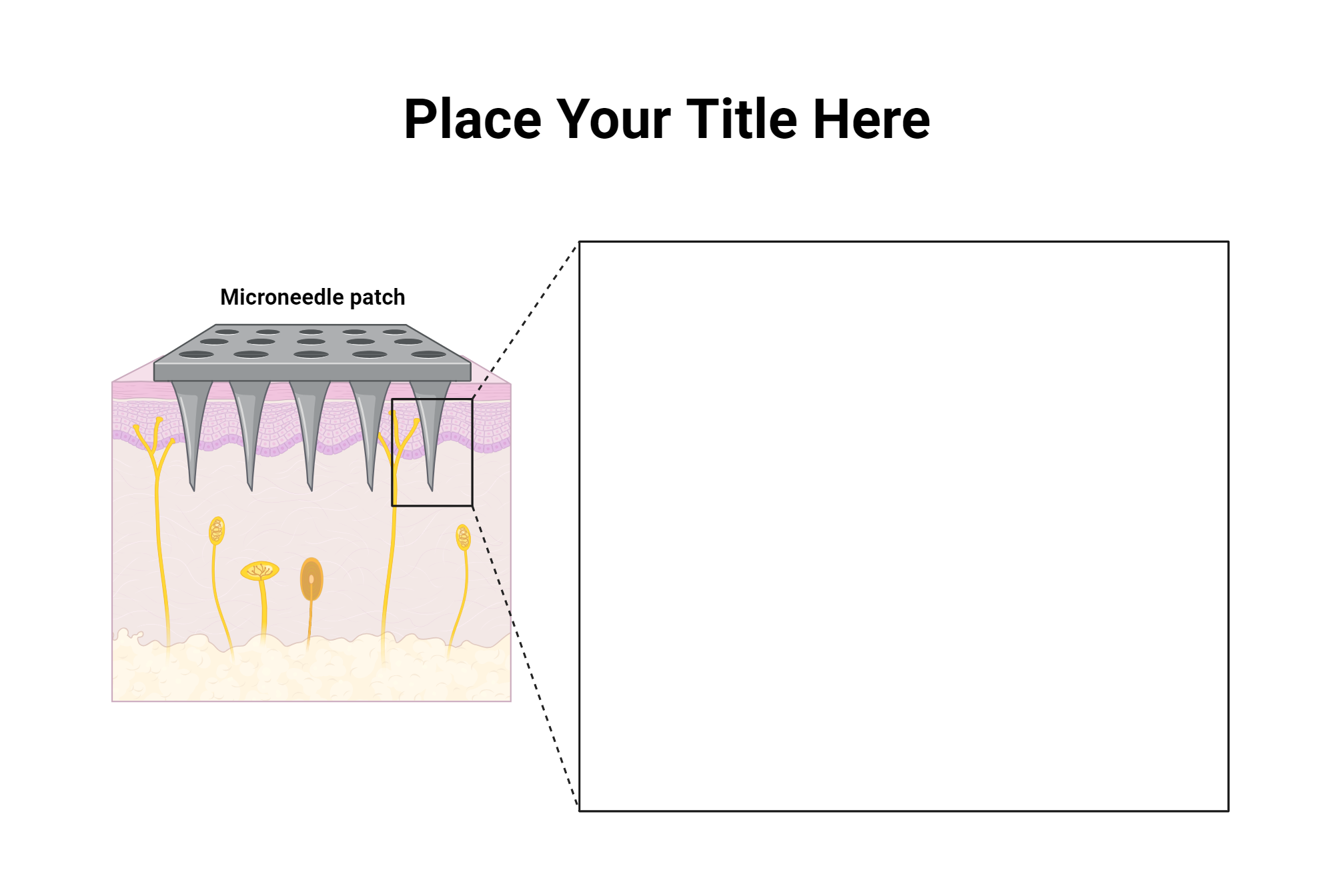 Transdermal Microneedle Patch (Callout) | BioRender Science Templates