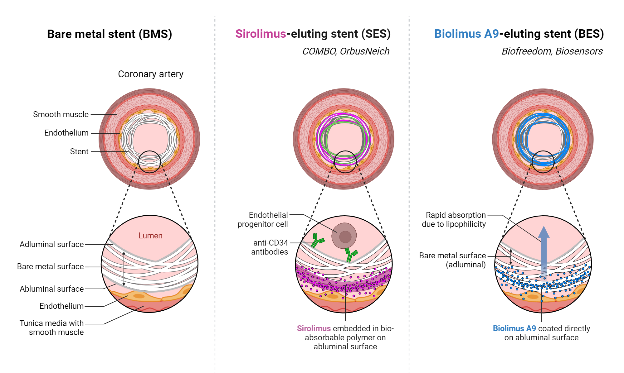 Drug-Eluted Stents | BioRender Science Templates