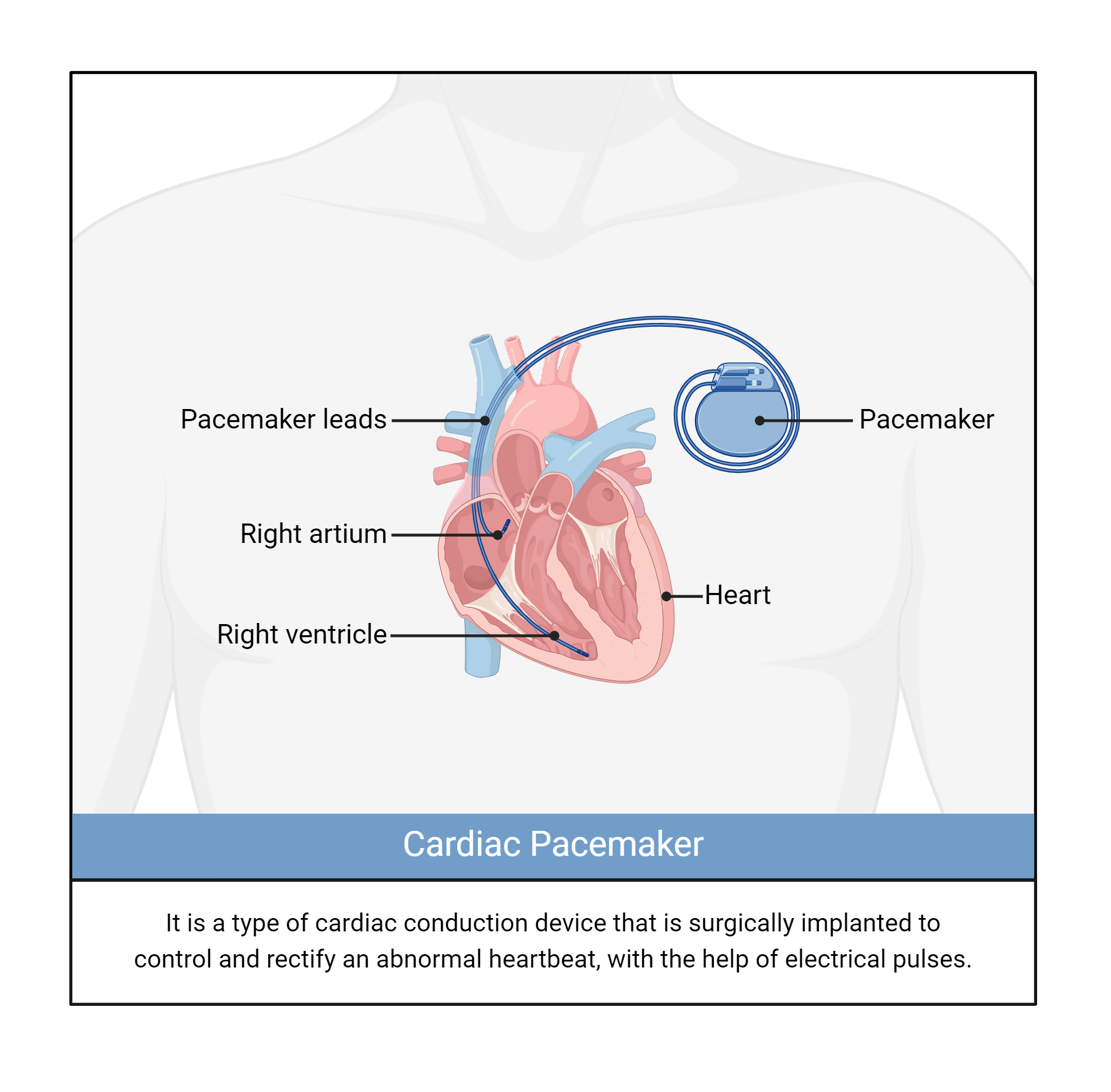 Cardiac Pacemaker Mechanism | BioRender Science Templates