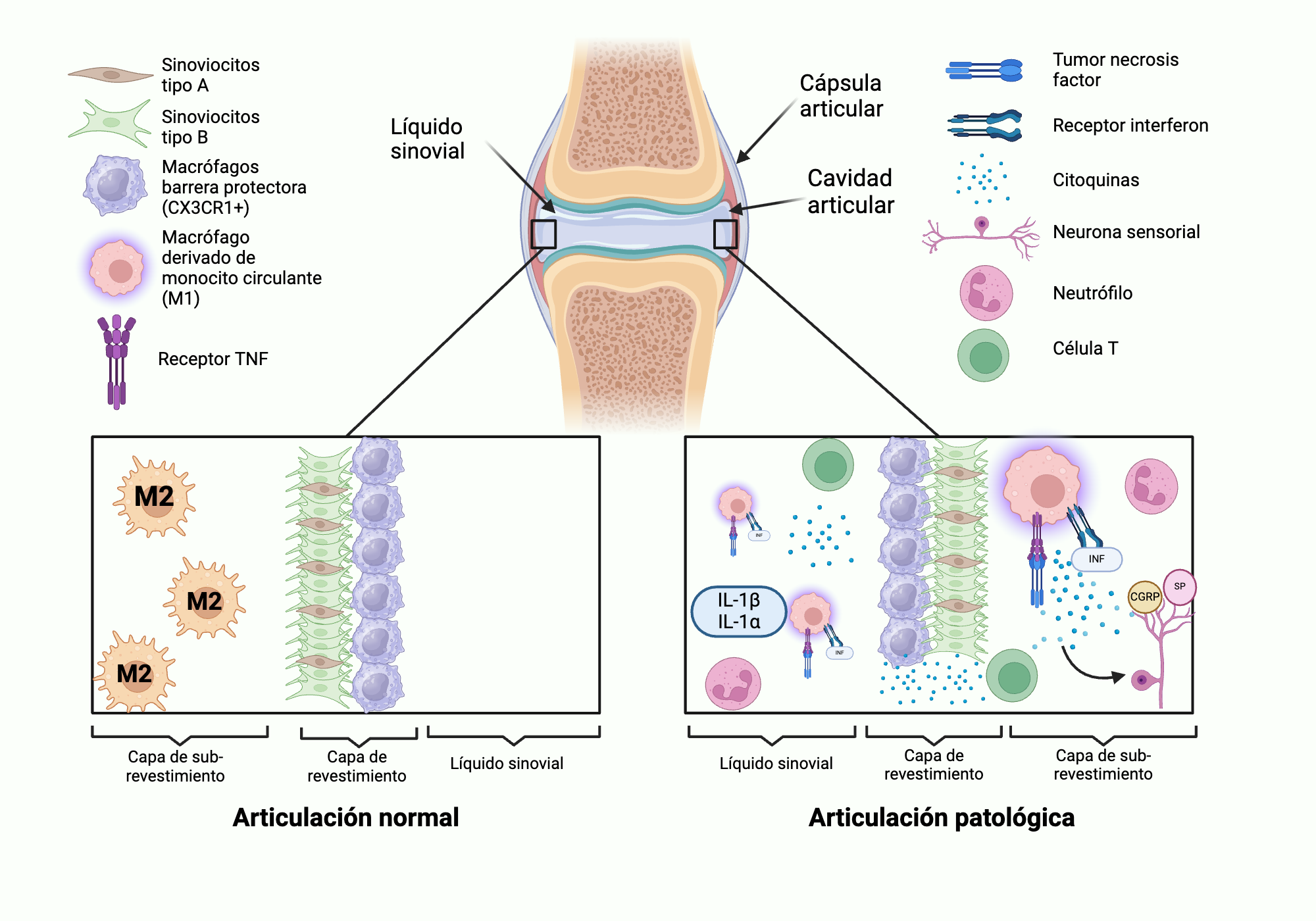 Inflammatory process involved in arthropathies | BioRender Science ...